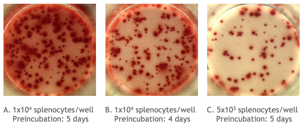 Troubleshooting B cell ELISPOT assay | U-CyTech Troubleshooting B cell ELISPOT assay | U-CyTech